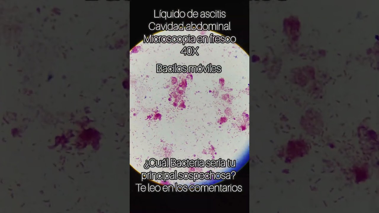 Líquido Ascitico. Cavidad Abdominal #laboratorio #laboratorioclínico #bacterias