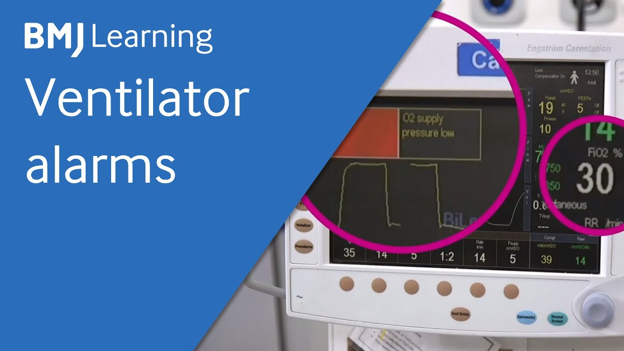 Understanding Ventilator Alarms: A Guide for Healthcare Professionals ...