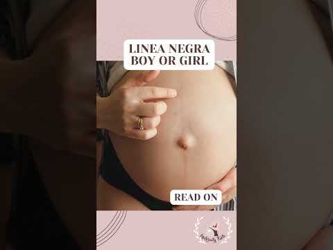 LINEA NIGRA! BOY OR GIRL! GENDER REVEAL! PREGNANCY! PREGNANT AFTER TTC! TTC! #ttc #shorts #pregnancy