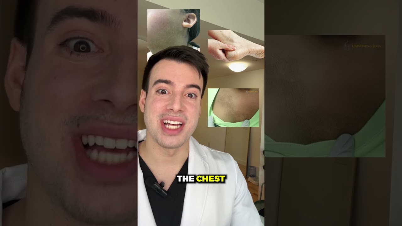 Is this dirty skin??? Derm explains