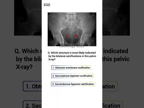 🩺Pelvic Anatomy Quiz: Identify the Finding!🤔 #radiologybuzz #anatomy