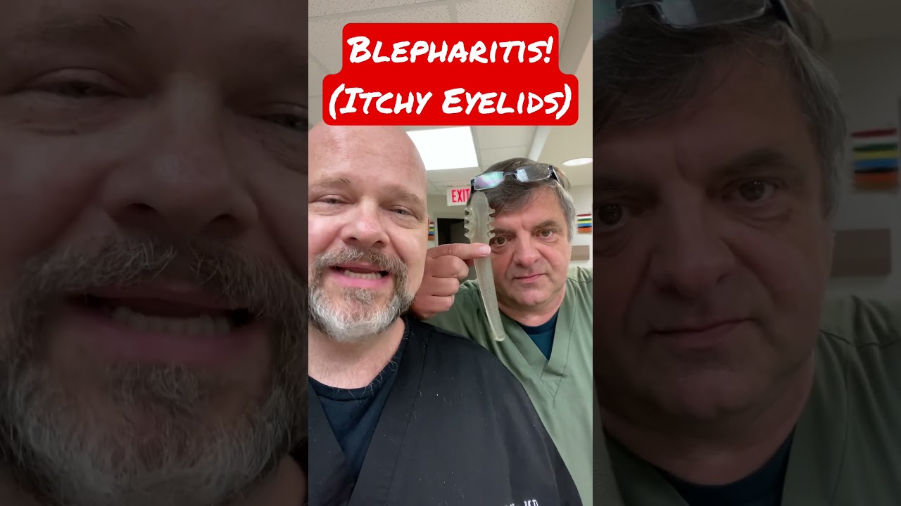 Itchy eyelids?  Could be Demodex!