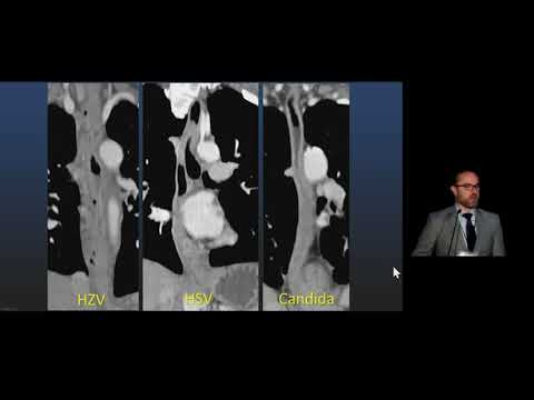 CT of Upper Gastrointestinal Emergencies | Free Radiology CME
