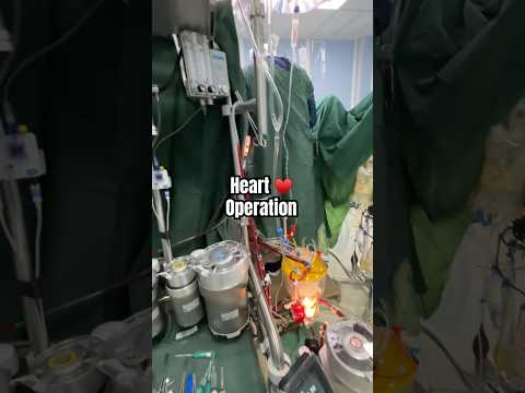 β₯οΈ Heart Operation ? Kaise Hoti hai Cardiac Surgery ? Dil ka operation ? Cardiac Bypass