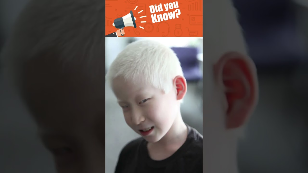 How Albino Chinese look like?