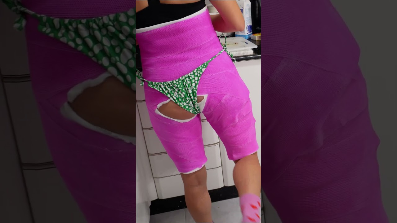 I got myself in a body cast for fun!