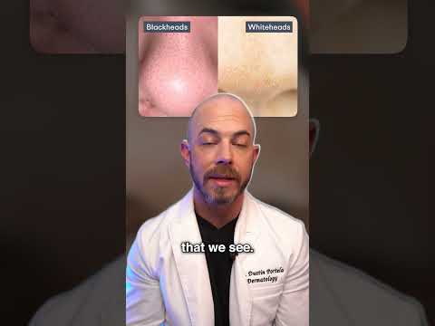 What is commodonal acne? Derm explains! #dermreacts #doctorreacts #commodonalacne