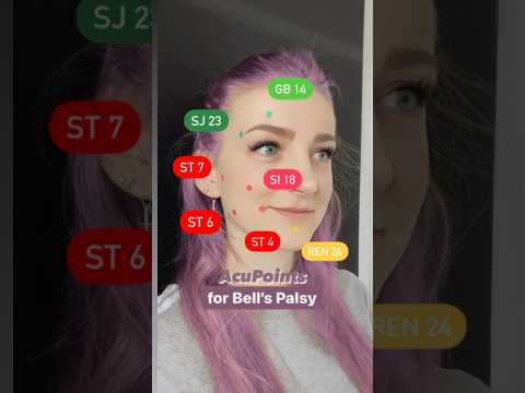 Acupuncture Points for Bell’s Palsy 🥴