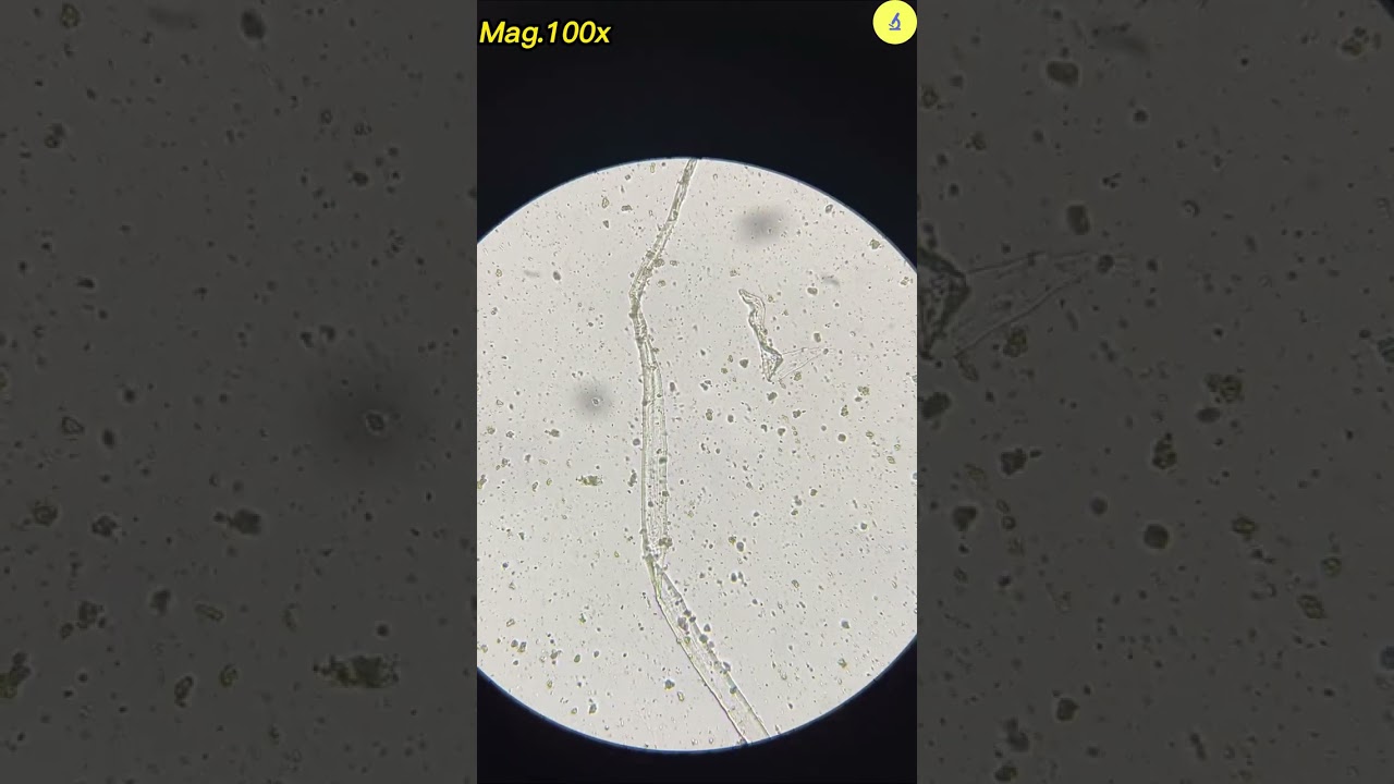 Condom Under Microscope | TULO - Microscope #shorts #underthemicroscope #condom