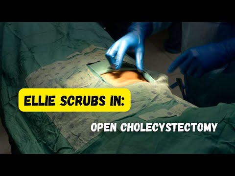 Ellie Scrubs In: Open Cholecystectomy | Step-by-Step Gallbladder Removal Procedure