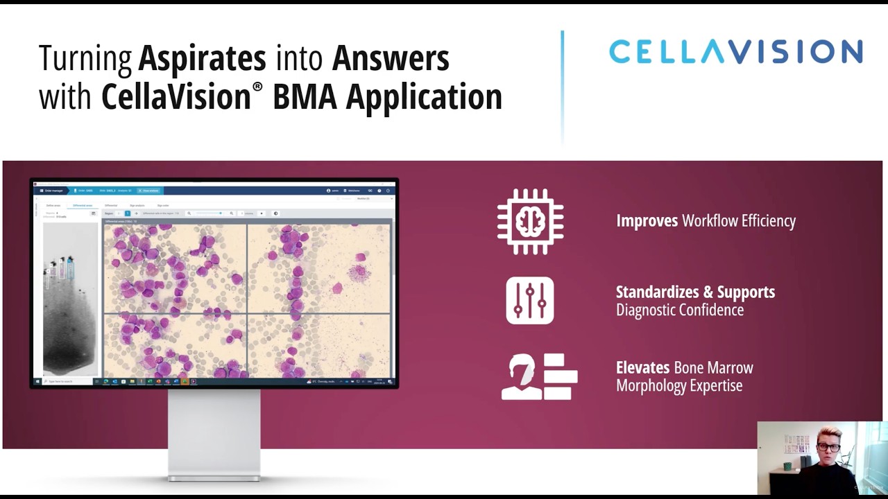 CellaVision® Bone Marrow Aspirate Application – Demo Video