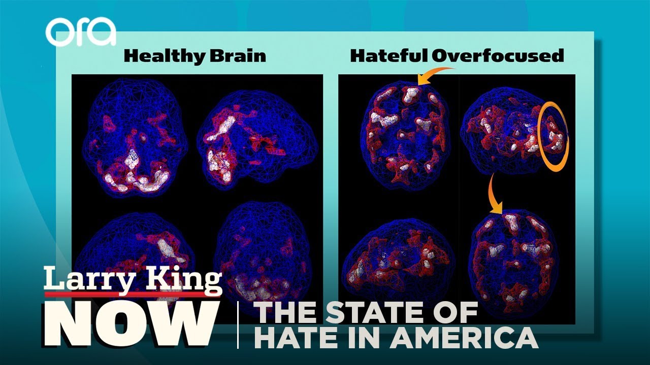 Inside “the brain on hate”