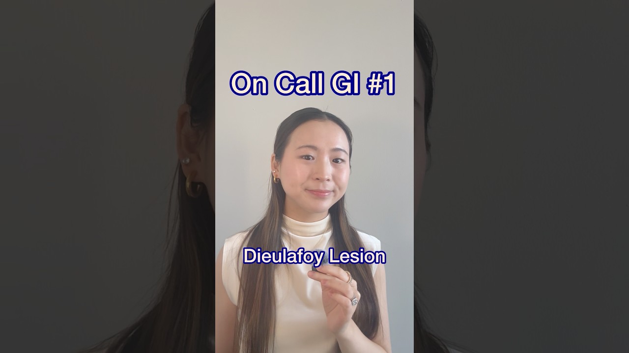 Dieulafoy Lesion: Massive GI Bleed with Normal EGD