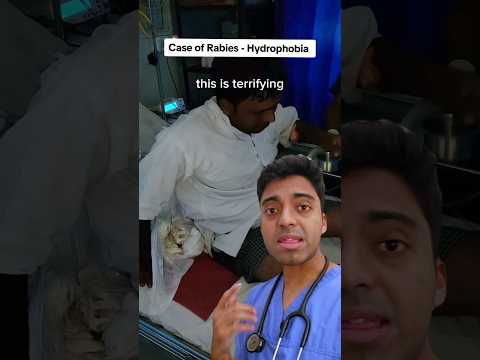 💦😱 This man is SCARED of water due to RABIES infection - Doctor Explains