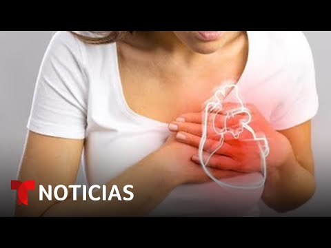 ¿Cuáles son los síntomas de un ataque cardíaco en mujeres? | Noticias Telemundo