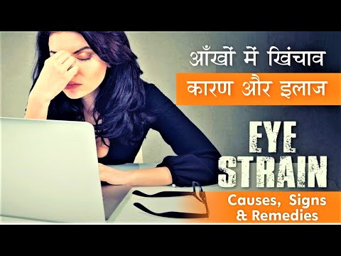 Eye Strain Causes, Signs & Treatment | Easy Tips to cure Eye strain आँखों में खिंचाव - कारण और इलाज