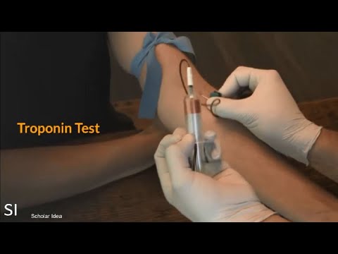 What is Cardiac Troponin?