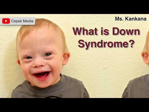 What is Down Syndrome | Biotechnology | General Medicine