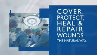 Human Tissue Allograft Videos and Brochures