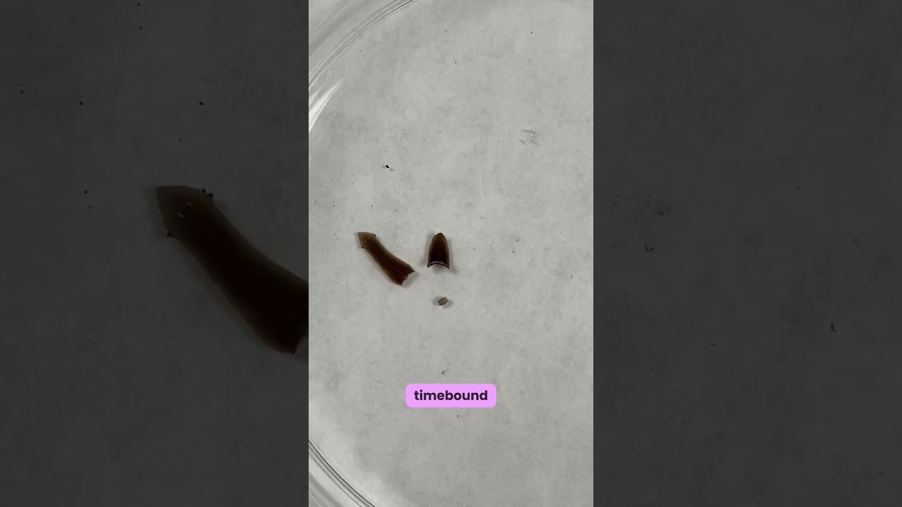 Regeneration in Planaria: Nature's Marvel