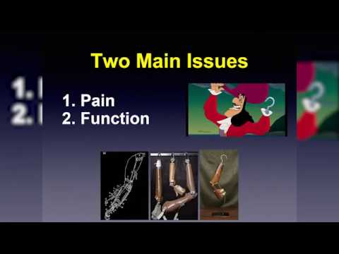 Dr. Nydick - Neuroma Management (TMR) - Florida Orthopaedic Institute