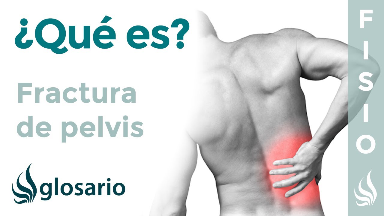 FRACTURA de PELVIS | Qué es, síntomas, signos clínicos, causas y tratamiento fisioterapéutico