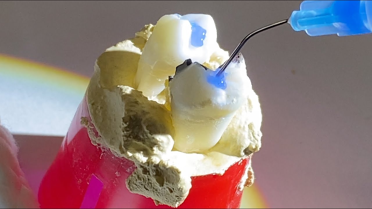 Hey Doc, What are Sealants?