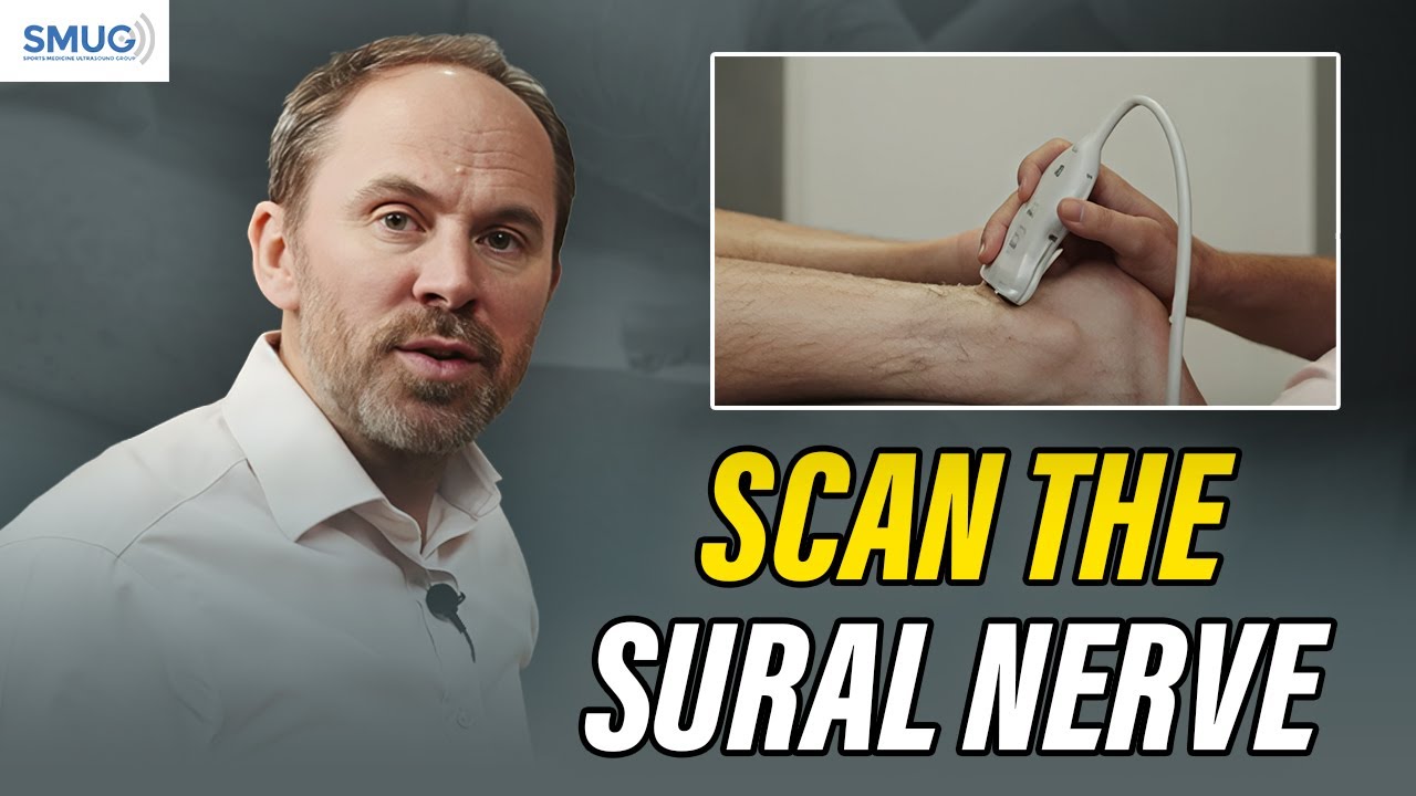 How to Find the Sural Nerve with MSK Ultrasound | For Achilles Pain & Injection Safety