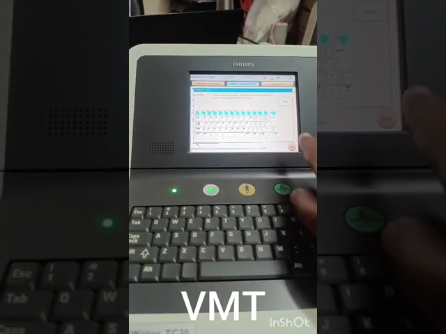 12 Channel Ecg Machine - Philips TC30 Ecg machine 12 channel Trader ...