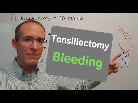 Tonsillectomy - Bleeding