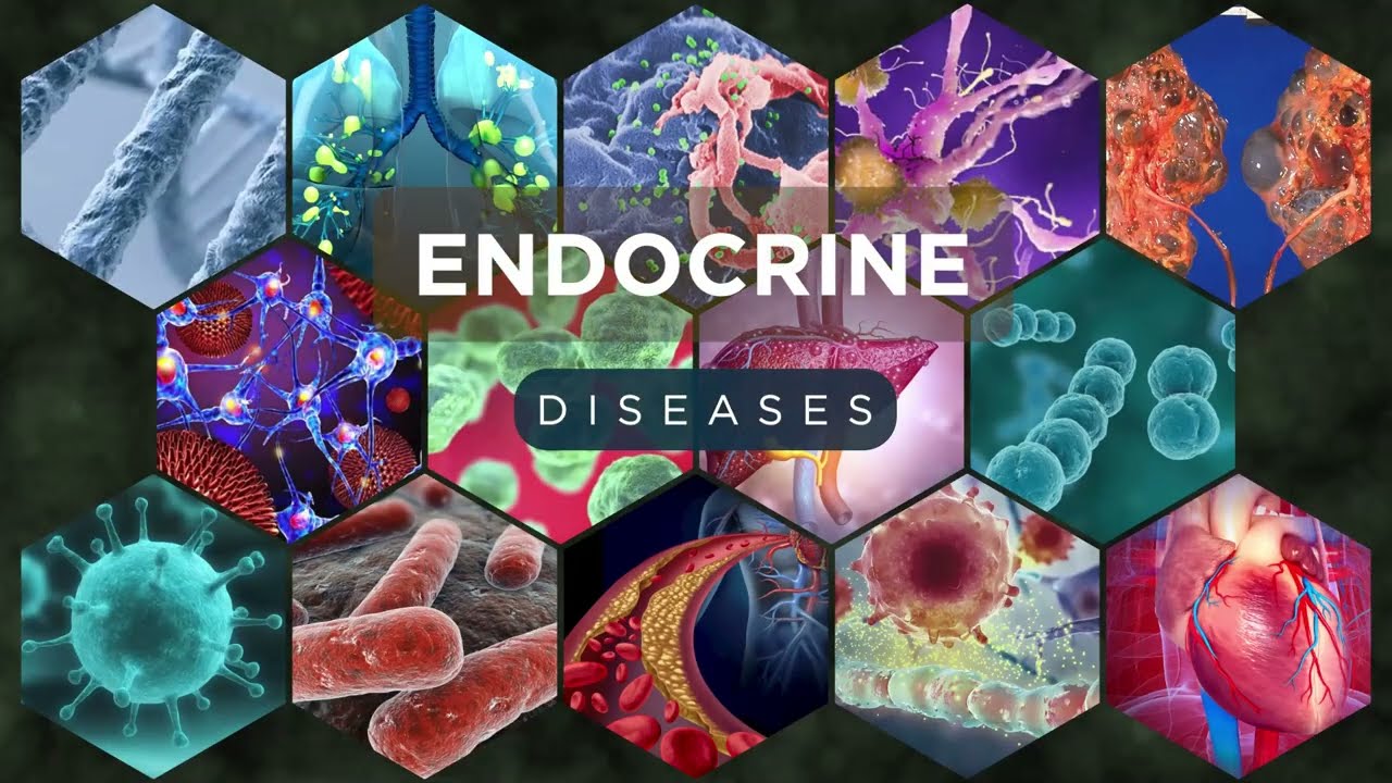 Endocrine Diseases Explained – Causes, Symptoms, & Treatments
