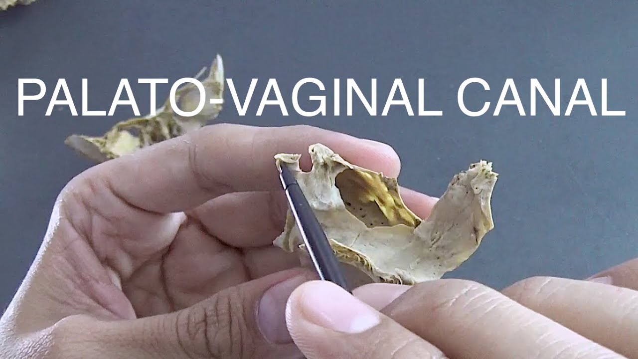 PALATO-VAGINAL CANAL