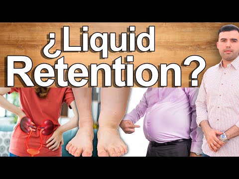Why Do I Suffer Fluid Retention? - Causes of Fluid Retention an How to Eliminate It Naturally