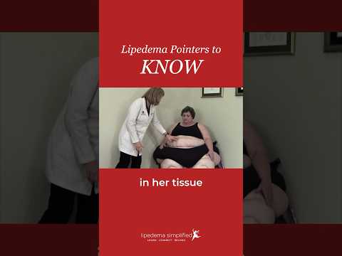 How to know if you have Lipedema or Lymphedema or both? #shortvideos #lipedema #lymphedema
