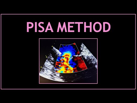 PISA METHOD! (Echocardiography/ MR assessment)