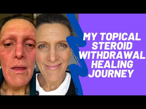MY TSW & ECZEMA HEALING JOURNEY #TOPICALSTEROIDWITHDRAWAL #TOPICALSTEROIDADDICTION #ECZEMACURE