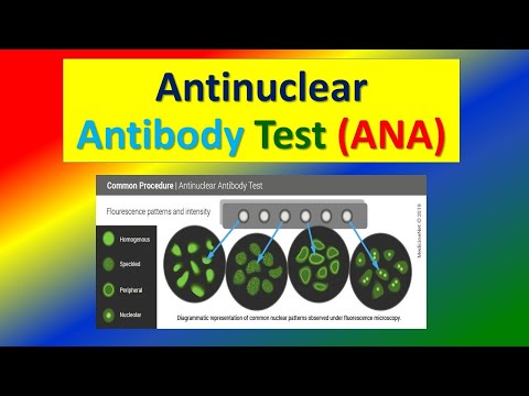 ANTINUCLEAR ANTIBODY TEST (ANA)