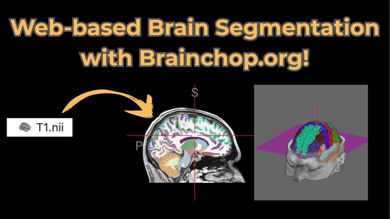 Web-Based Brain Segmentation with Brainchop.org!