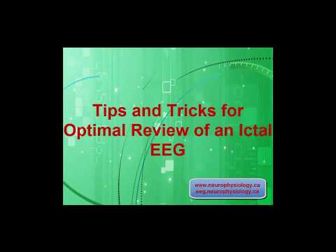 Tips and Tricks for Optimal Review of an Ictal EEG