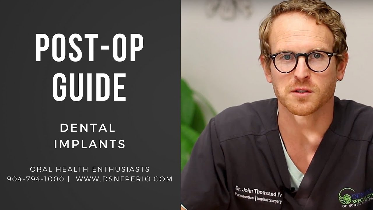 Post-Operative Guide to Dental Implants | Dr. John W. Thousand IV