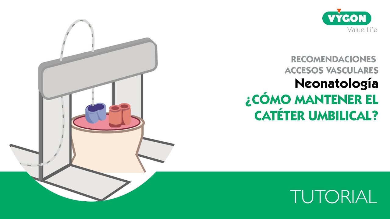 ¿Cómo mantener el catéter umbilical? - Tutorial