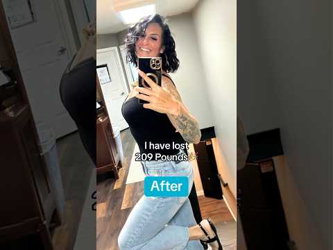 I LOST 200 LBS! Gastric Sleeve π