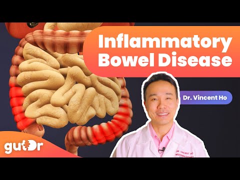 Inflammatory Bowel Disease (IBD) | The GutDr Explains (3D Gut Animation)