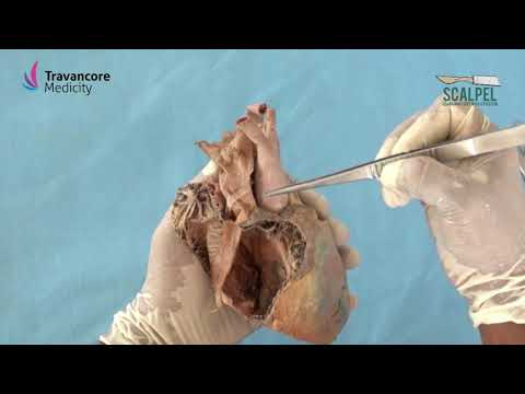 Heart: Right atrium