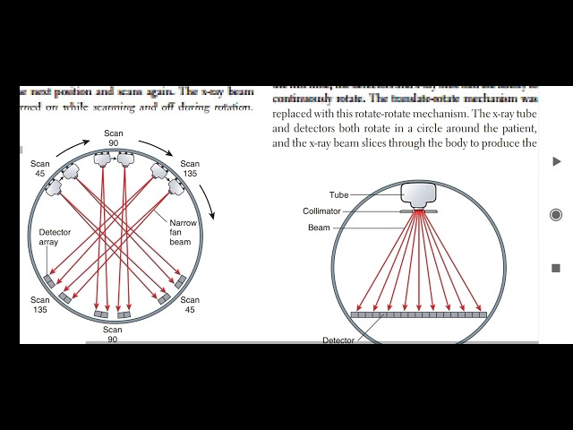 Understanding CT Scanner Generations: A Comprehensive Overview | Galaxy.ai