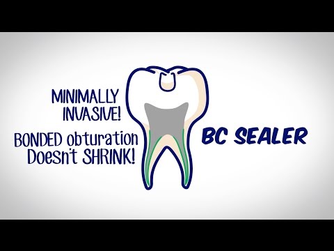 A Whiteboard Video Introduction of BC Sealer