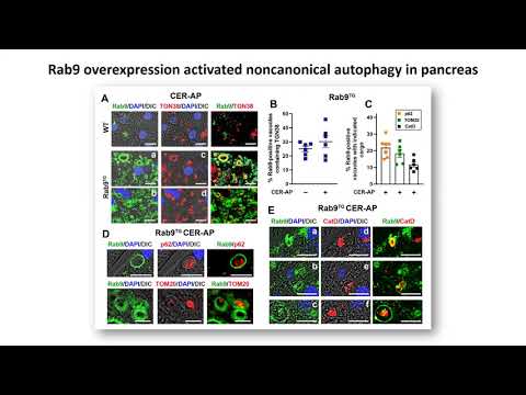 Autophagy Switch from Canonical, LC3-mediated to Noncanonical, Rab9-mediated Pathway Causes Pancreas