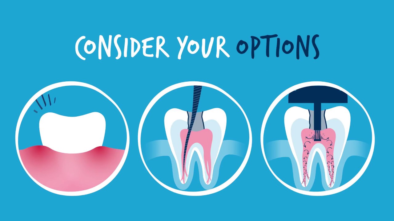 An Effective Alternative to Standard Root Canal Treatment