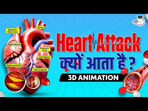 Why HEART ATTACKS Happen? | हार्ट अटैक कैसे होता है? | 3D Animation | StudyIQ IAS