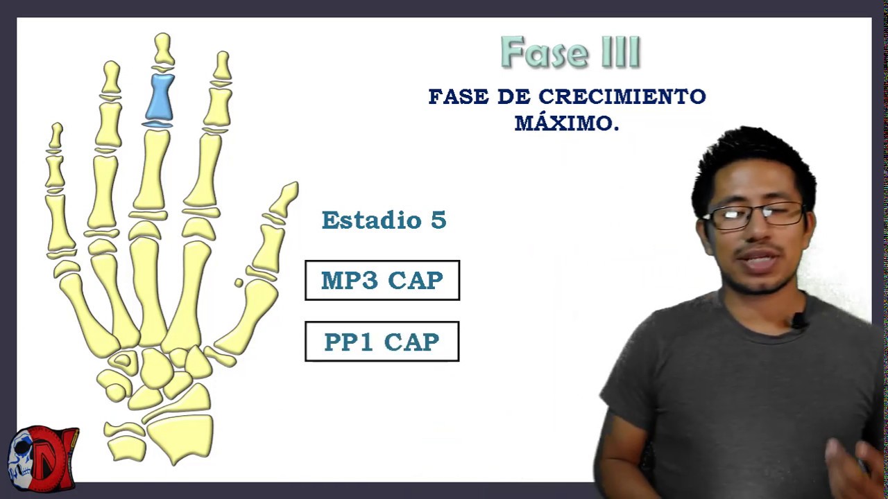 Carpal X-ray in Orthodontics, in just 8 minutes